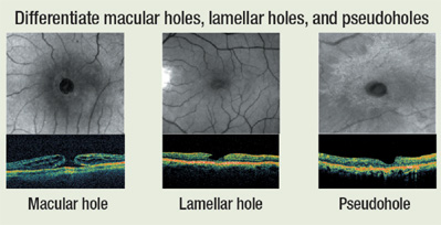 Ophthalmology Management | PentaVision