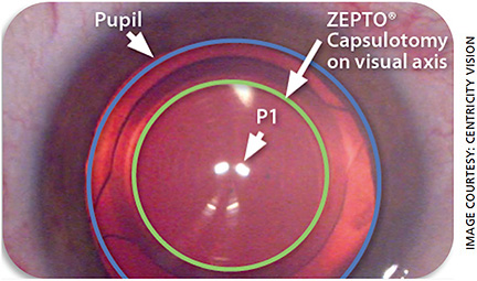 Ophthalmology Management | PentaVision