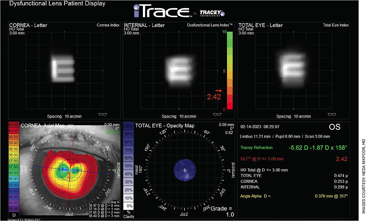 Ophthalmology Management | PentaVision