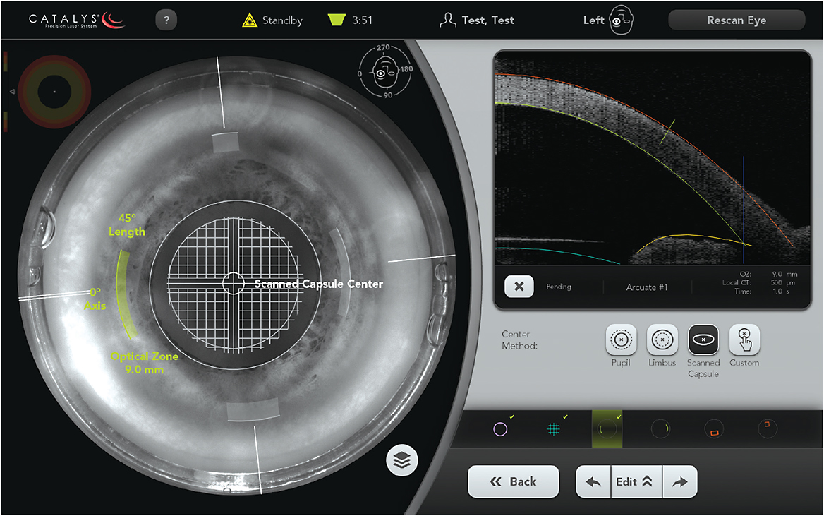 Ophthalmology Management | PentaVision