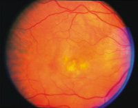 Ophthalmology Management | PentaVision