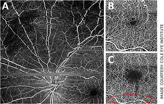 Ophthalmology Management | PentaVision