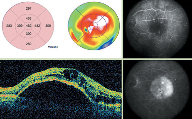 Ophthalmology Management | PentaVision
