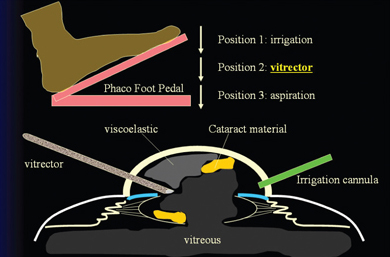 Ophthalmology Management | PentaVision