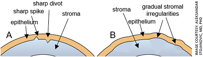 Ophthalmology Management | PentaVision