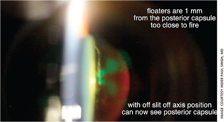 Ophthalmology Management | PentaVision