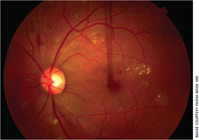 Ophthalmology Management | PentaVision