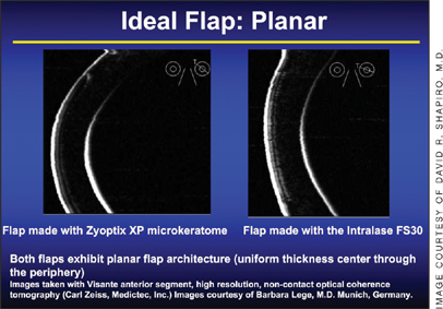 Ophthalmology Management | PentaVision