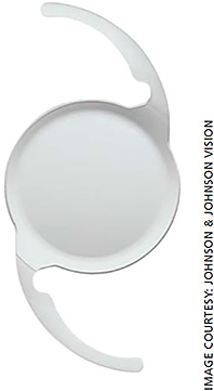 Ophthalmology Management | PentaVision