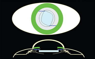 Ophthalmology Management | PentaVision