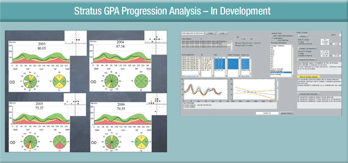 Ophthalmology Management | PentaVision