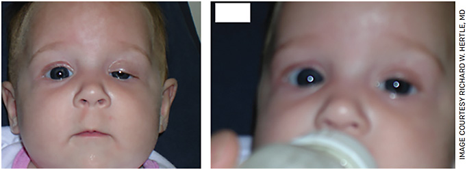 Ophthalmology Management | PentaVision