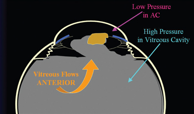 Ophthalmology Management | PentaVision