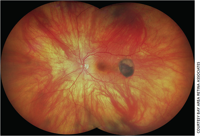 Ophthalmology Management | PentaVision