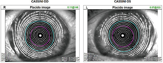 Ophthalmology Management | PentaVision