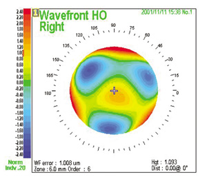 Ophthalmology Management | PentaVision