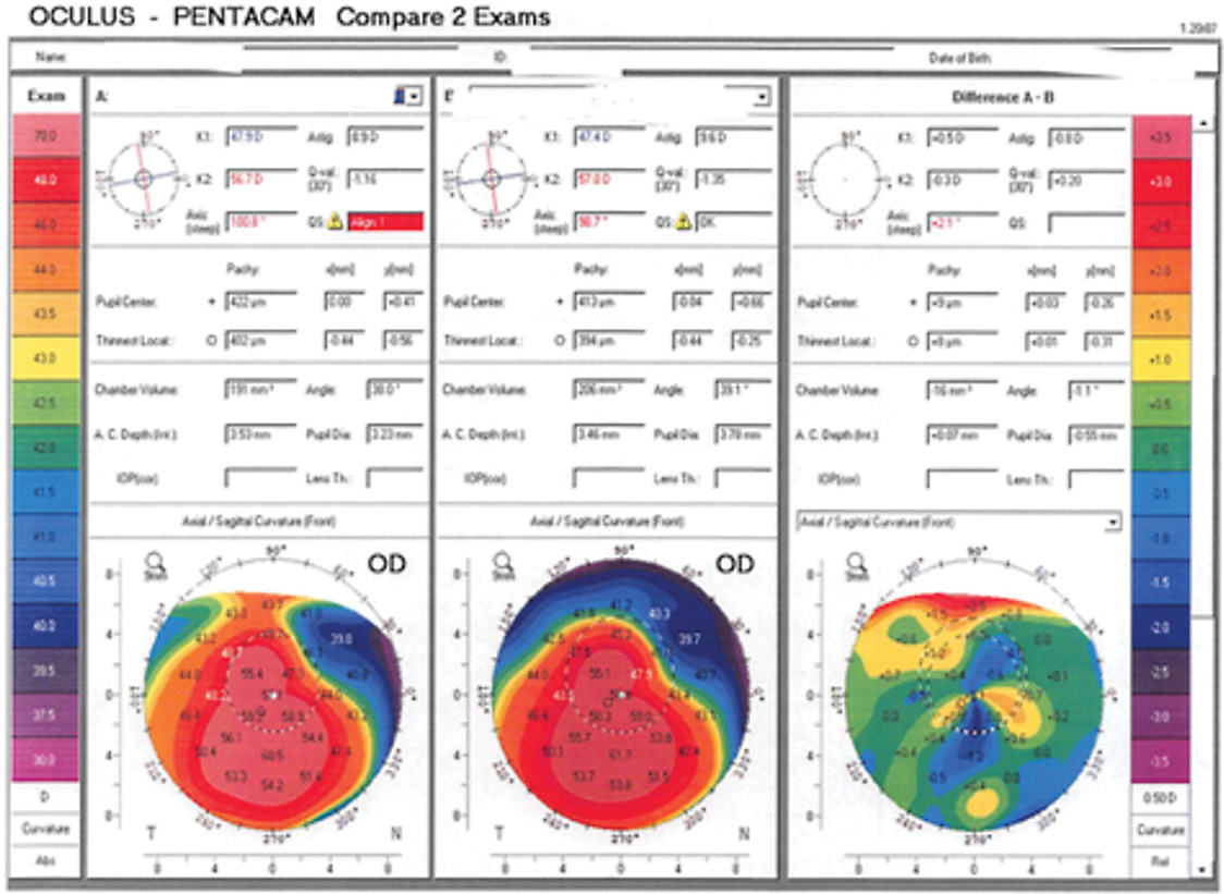 Ophthalmology Management | PentaVision