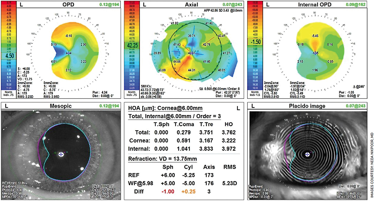 Ophthalmology Management | PentaVision