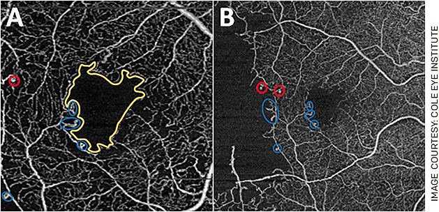 Ophthalmology Management | PentaVision