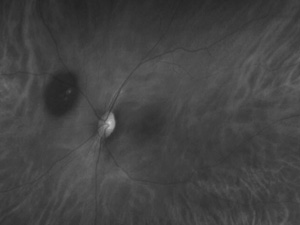 Ophthalmology Management | PentaVision