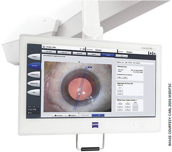 Ophthalmology Management | PentaVision