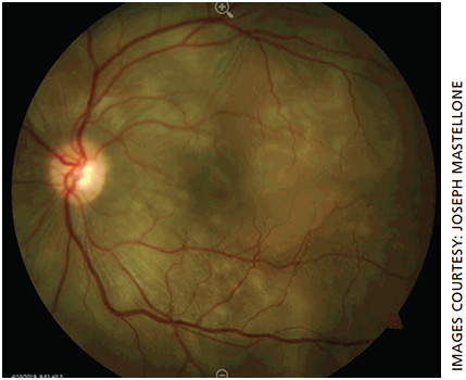Ophthalmology Management | PentaVision