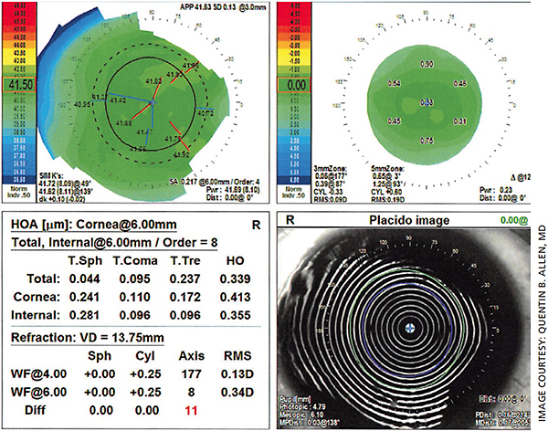 Ophthalmology Management | PentaVision