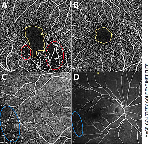 Ophthalmology Management | PentaVision