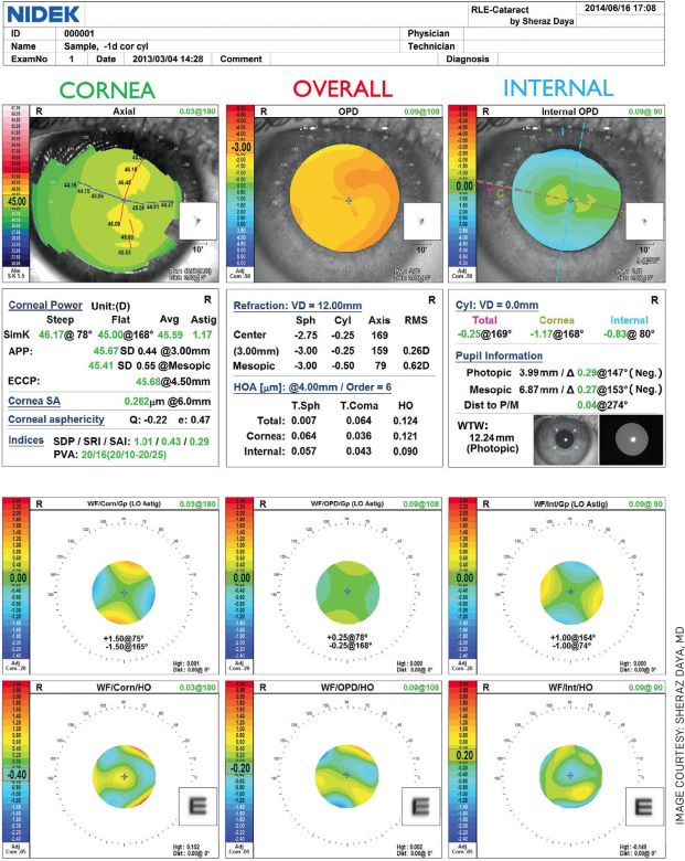 Ophthalmology Management | PentaVision