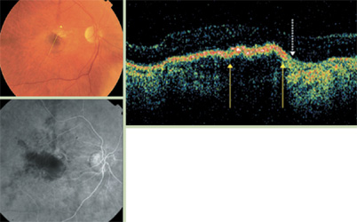 Ophthalmology Management | PentaVision