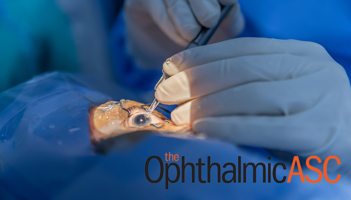 Eliminate “Wrong Events” in the Operating Room | Ophthalmology Management