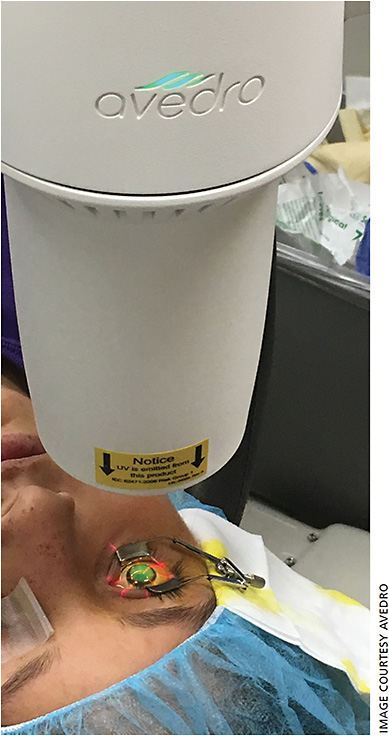 Ophthalmology Management | PentaVision