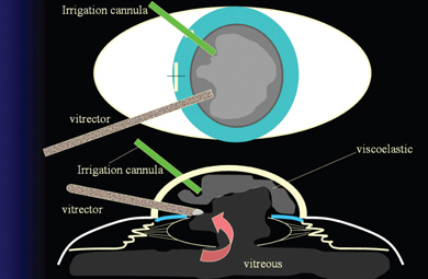 Ophthalmology Management | PentaVision