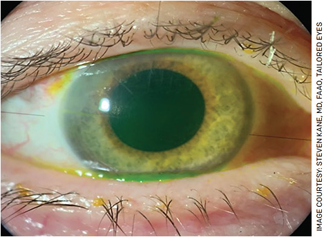 Ophthalmology Management | PentaVision