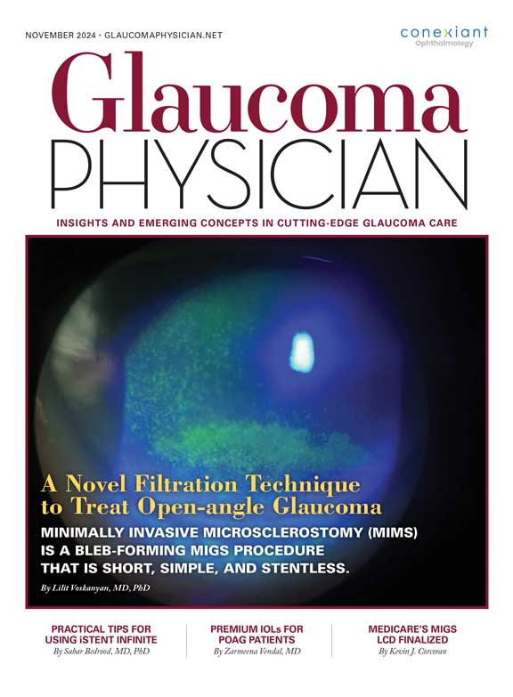Glaucoma Progression Detection Part 2 Ophthalmology Management