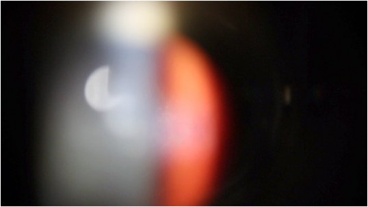 Ophthalmology Management | PentaVision