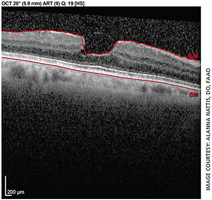 Ophthalmology Management | PentaVision