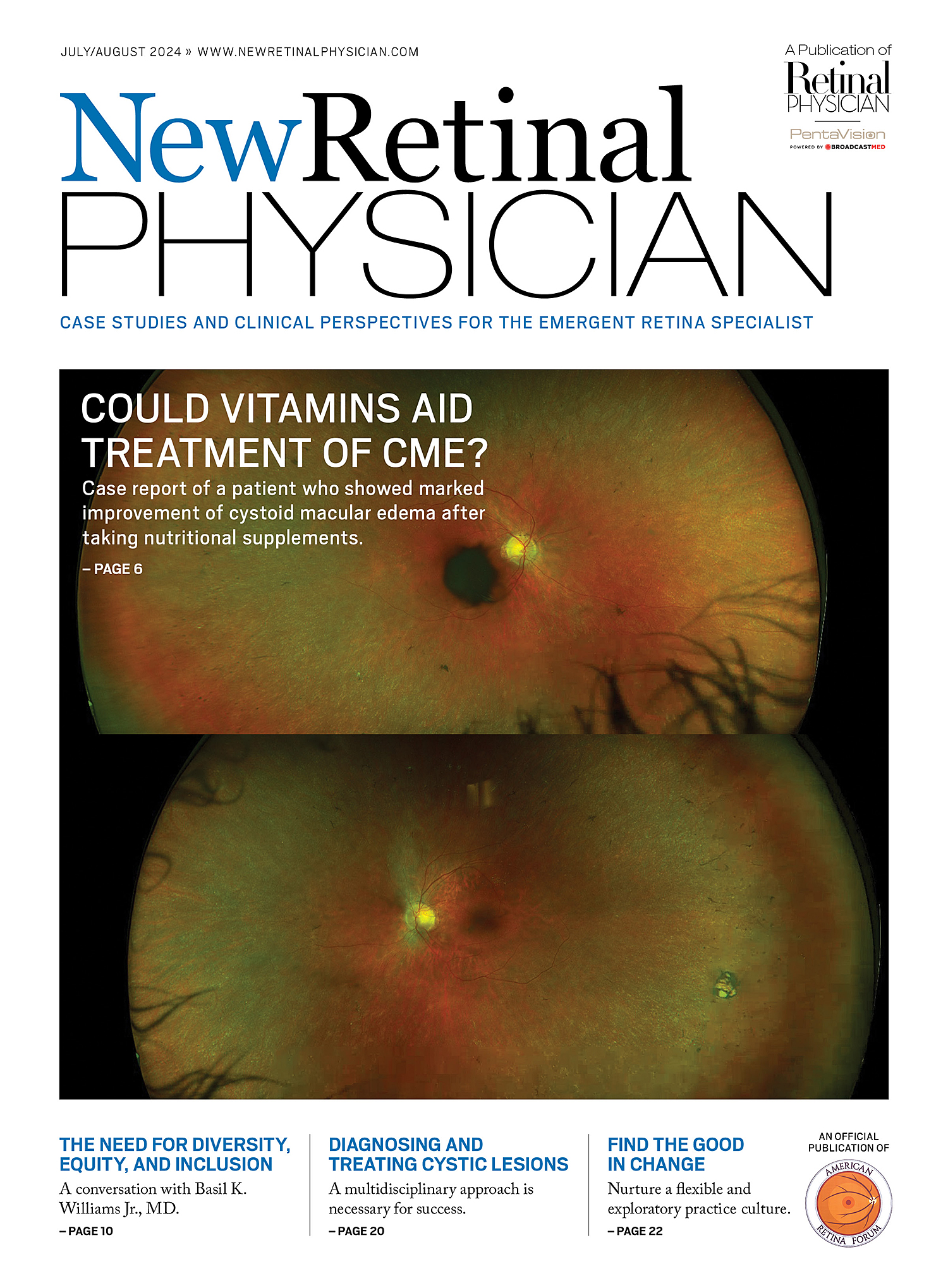 July | Ophthalmology Management