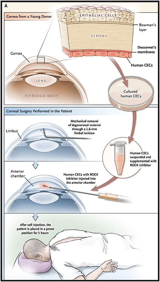 Ophthalmology Management | PentaVision