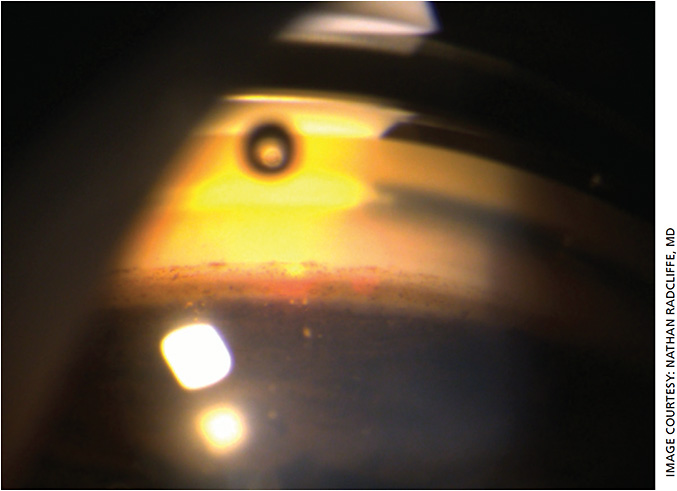 Ophthalmology Management | PentaVision