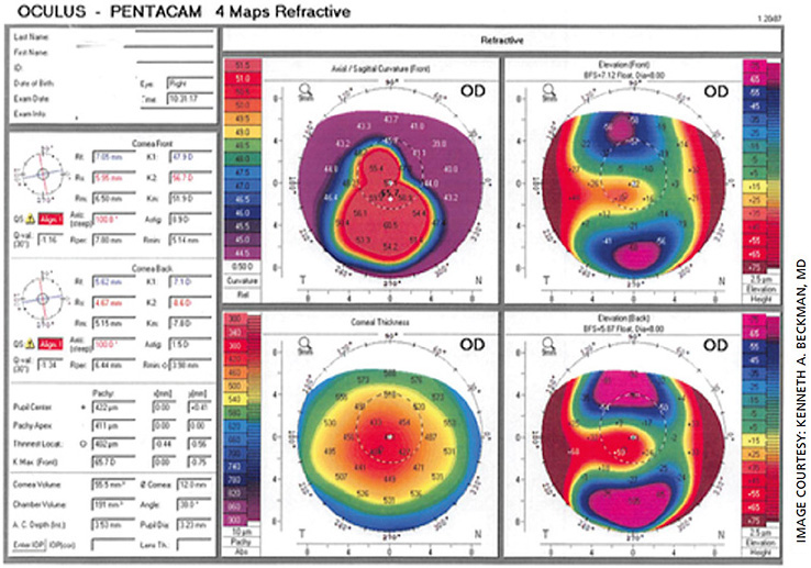Ophthalmology Management | PentaVision