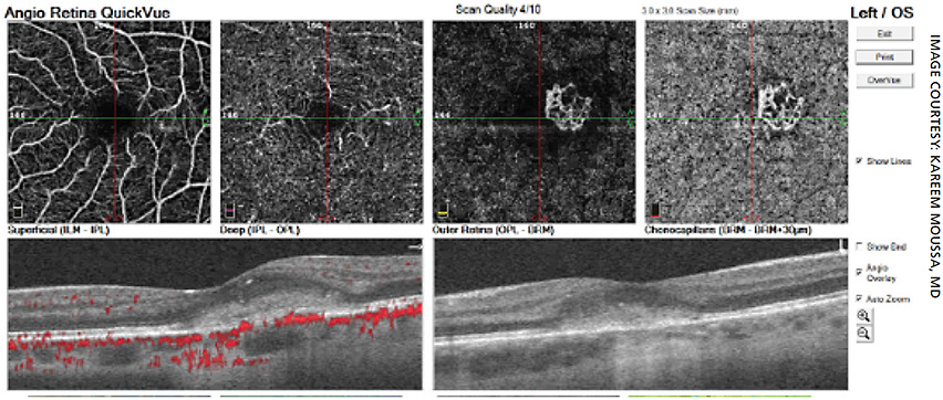 Ophthalmology Management | PentaVision