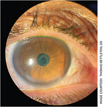 Ophthalmology Management | PentaVision