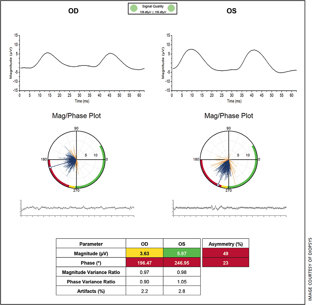 Ophthalmology Management | PentaVision