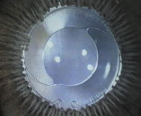 Ophthalmology Management | PentaVision