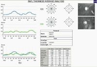 Ophthalmology Management | PentaVision