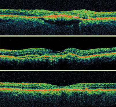 Ophthalmology Management | PentaVision