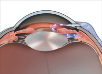 Ophthalmology Management | PentaVision