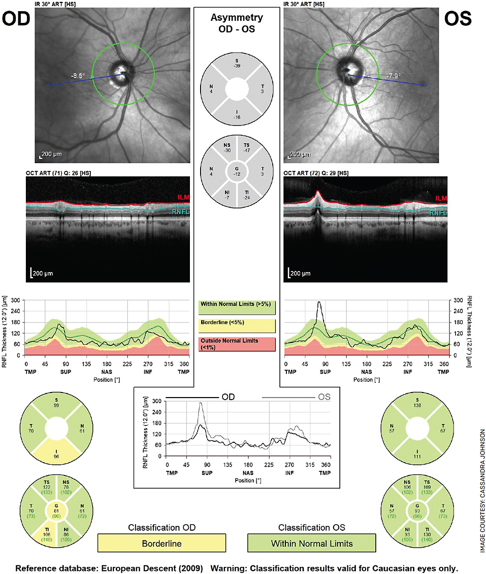 Ophthalmology Management | PentaVision