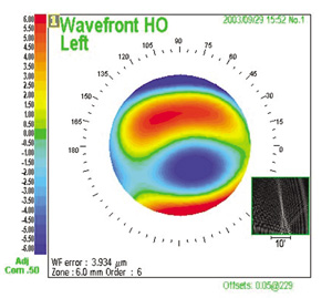 Ophthalmology Management | PentaVision